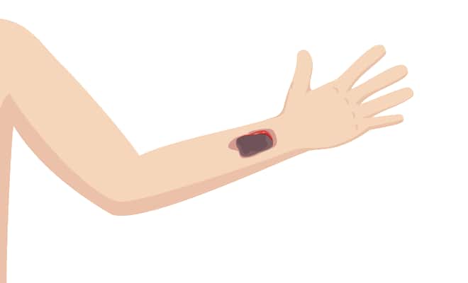 Want to enhance wound care knowledge at your facility?